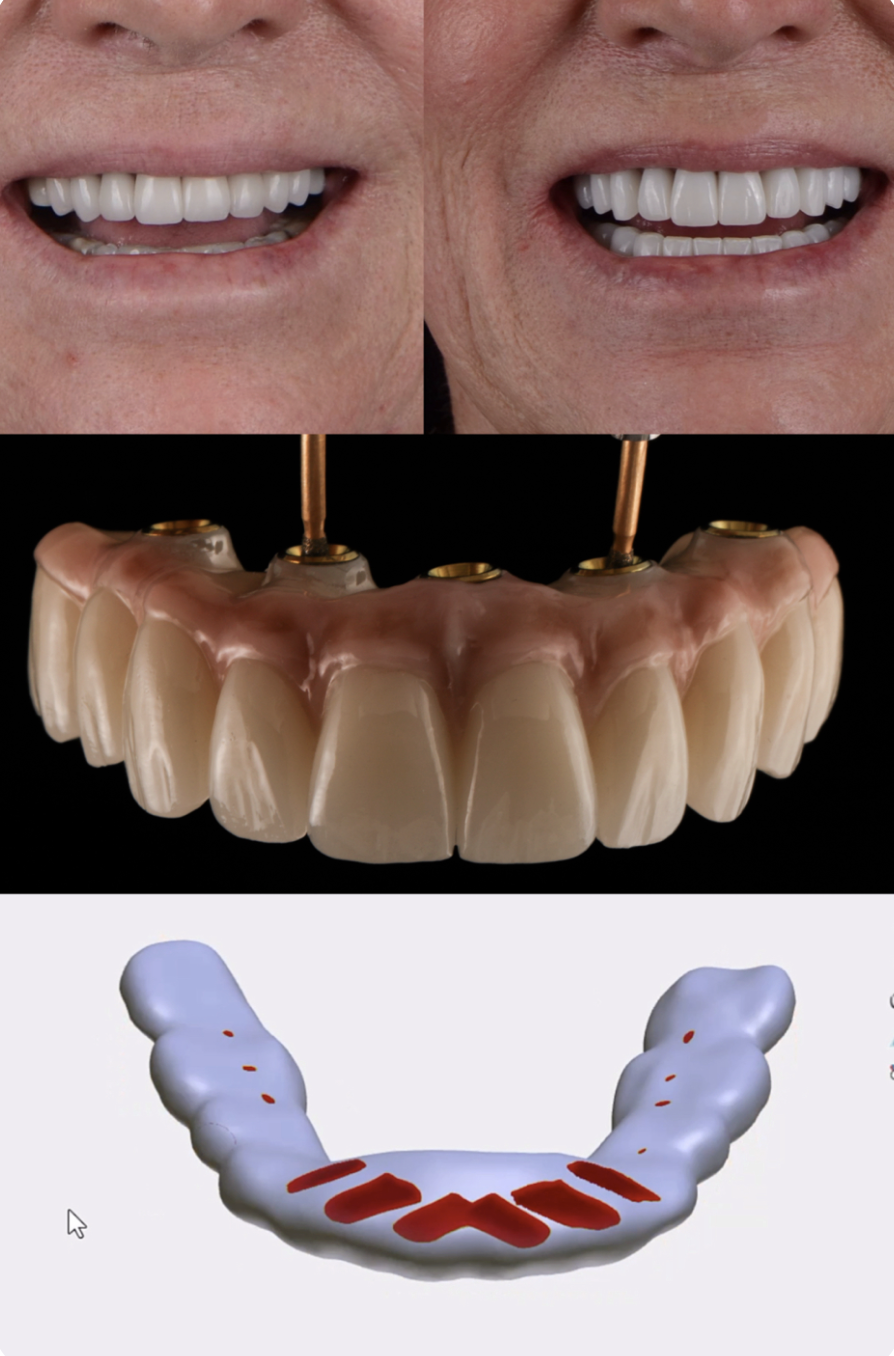 Digital Mastery: A One-Year Online Mentorship - Digital Dentistry Training